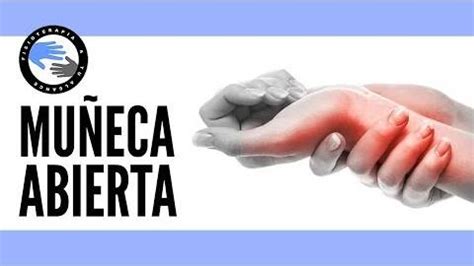 Esguince de muñeca Fisioterapia a tu alcance
