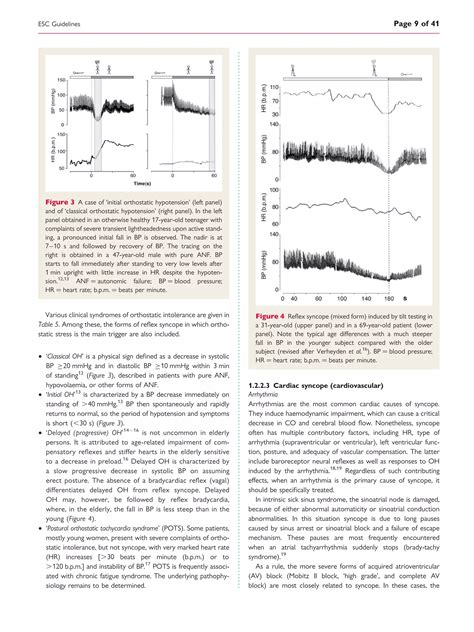 2009 Esc Guideline Of Syncope Pdf