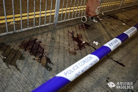 元朗水邊圍邨男子候車期間遇襲！頸部受傷血流如注送院救治！ Lihkg 討論區