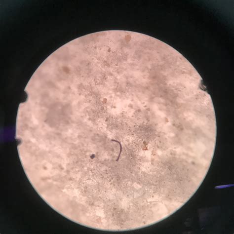 Do We Have An International Standardized Definition On Microplastics Morphology Researchgate