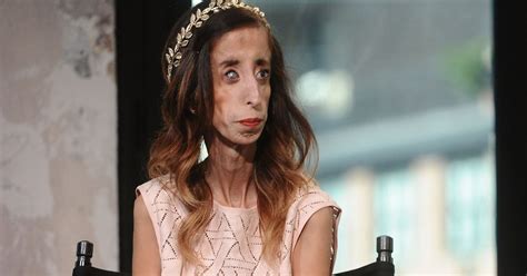 Lizzie Velasquez Shares Moving Message About Online Bullying Huffpost