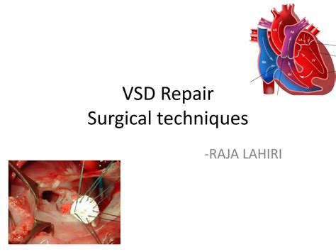 Vsd Surgery Pptx