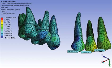Displacement In Y Axis At Occlusal Point In Ribbonarch Appliance With Download Scientific