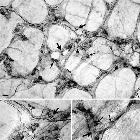 A E P2x 3 Ir In Nerve Cell Bodies In Myenteric Plexus Of The Developing Download Scientific