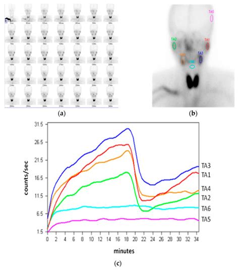Diagnostics Free Full Text Recent Advances In Salivary