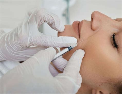 Smile Lines Botox Treatment At The Skin Company
