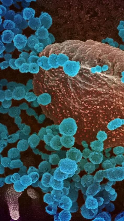 Most Dangerous Viruses In The World