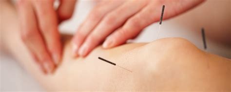 Acupuncture And Tendon Health