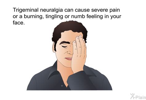 PatEdu Com Trigeminal Neuralgia