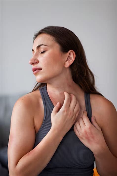 Are Eczema Symptoms Different On Face And Neck Onlymyhealth