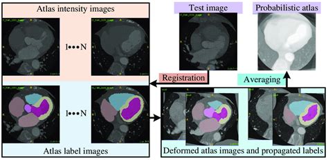 Illustration Of Probabilistic Atlas Based Segmentation For The Whole