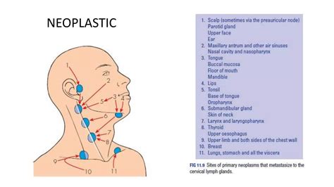 Branchial Cysts Etpptx