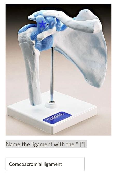 Name The Ligament With The [ ] Coracoacromial Ligament