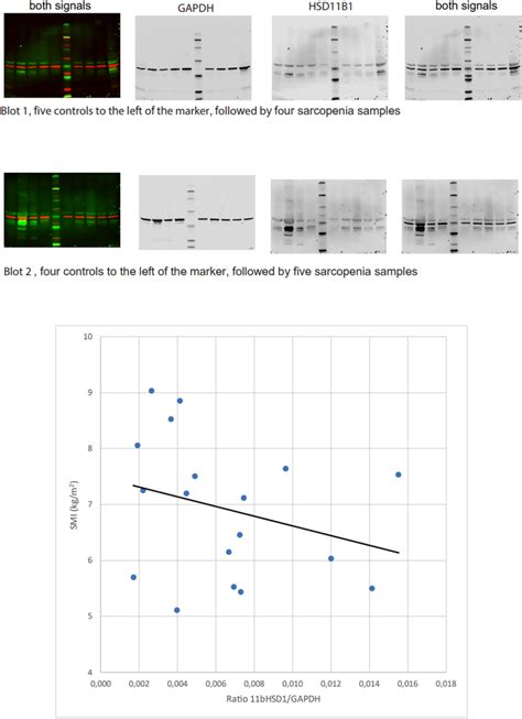 Correlation Between Smi And Hsd11b1 In Western Blot Pearsons
