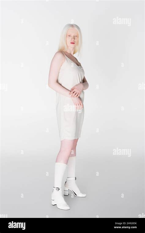 Full Length Of Trendy Albino Model In Dress And Hells On White