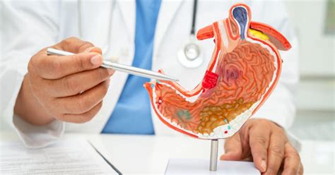 Gastritis And The Gastric Antrum Understanding The Connection