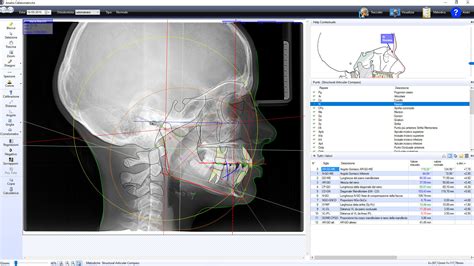 Analysis Software Orthotp Microlab For Orthodontics