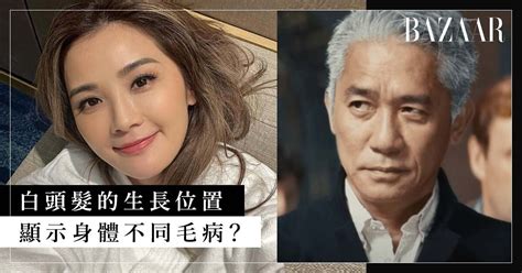 白頭髮位置顯示出身體不同毛病，甚至生殖器官！要長出烏黑頭髮有甚麼方法？