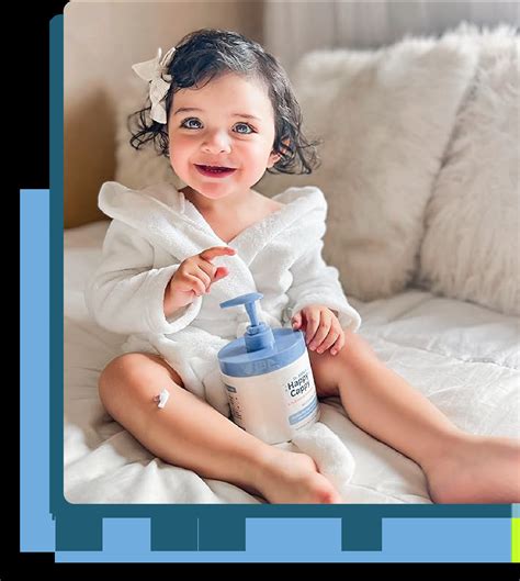 Dandruff Flakes Under Microscope Symptoms Causes And Treatment