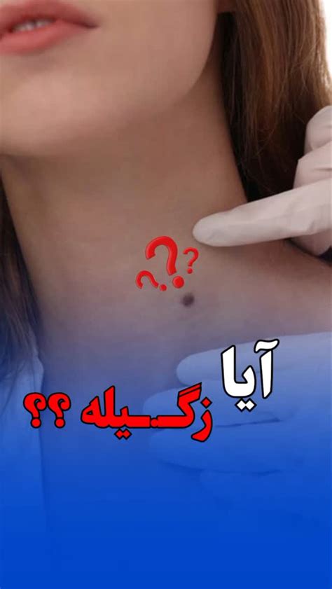 جاوید》 کارشناس زگیل تناسلی تبخال تناسلی مشکلات رحمی‎ ‎جهت تشخیص و در مان زگ یل و تب خال