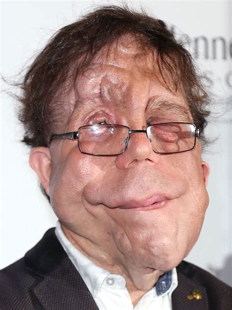 Adam Pearson Actor