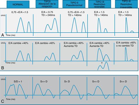 Análisis De La Función Diastólica Del Ventrículo Izquierdo Mediante Resonancia Magnética