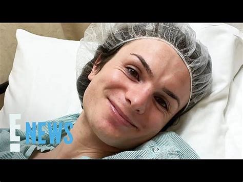 What Is Facial Feminization Surgery Dylan Mulvaney New Face Reveal