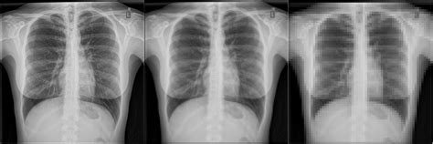 General Imaging Characteristics Medical Imaging For Undergrads