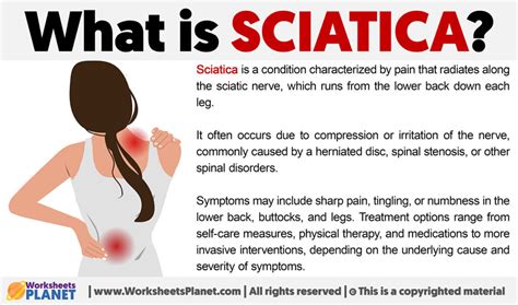 What Is Sciatica Definition Of Sciatica