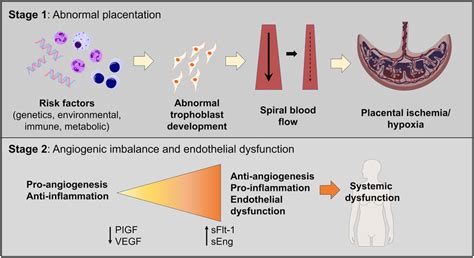 Two Staged Model Of Preeclampsia Pathogenesis Stage 1 Consists Of The Download Scientific