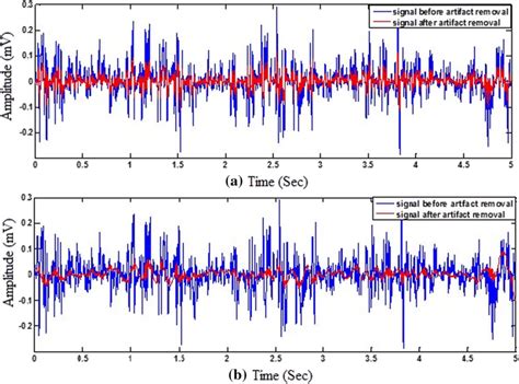 A EEG Signal Comparison After EEMD ICA SWT Artifact Removal Algorithm