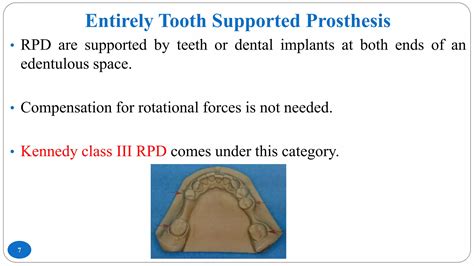 Rpi And Rpa System Pptx Dental Health Diseases And Conditions