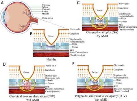 How To Make A Schematic Diagram Pathophysiology