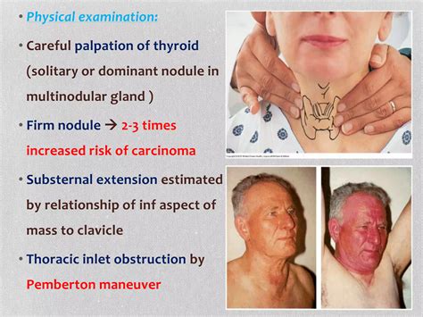 Approach To Thyroid Nodule Pptx