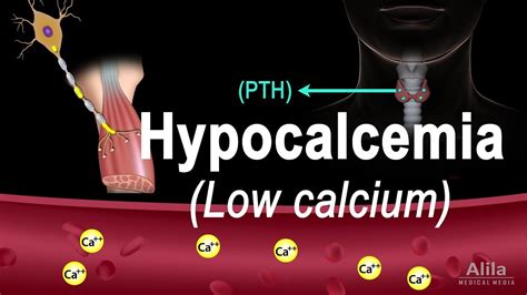 Why Does Hypocalcemia Cause Tetany