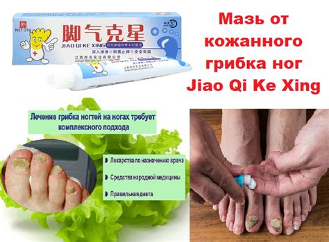 Мазь от кожанного грибка и пота ног Jiao Qi Ke Xing (желтые ножки) в ...