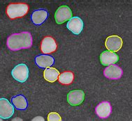 Morphology MVTec Software