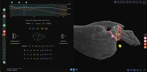 Web Based 3d Imaging Exploration Vidaa Platform Left Morphological Download Scientific