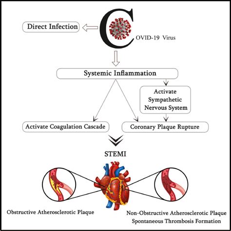 Arterial Thrombosis
