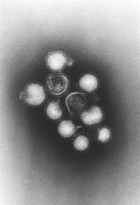 Electron Microscope Flu Virus