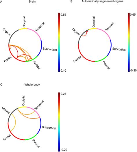 Figure 3 From Whole Body Metabolic Connectivity Framework With