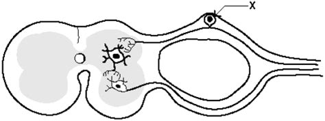 Solved Cell Body Of The Motor Neuroncell Body Of The Motor