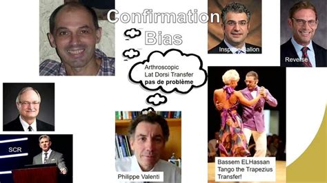 Codman Shoulder Society On Linkedin The Borderline Between Joint Preservation And Rsa Factors