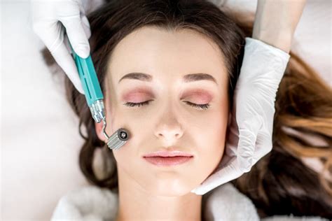 Revitalización Post Microneedling 4 Consejos Clave Para La Piel