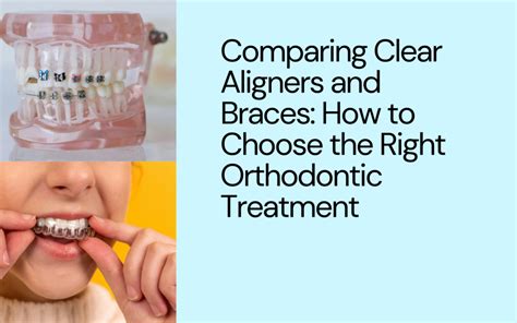 Comparing Clear Aligners And Braces How To Choose The Right Orthodontic Treatment