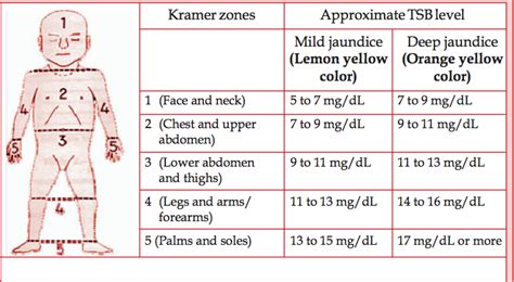 Neonatology Kramers Pedia4pg By Dr Sidharth Sethi Facebook