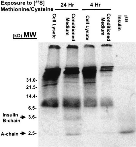 Post Translational Insulin Processing In Primary Cultured Hepatocytes