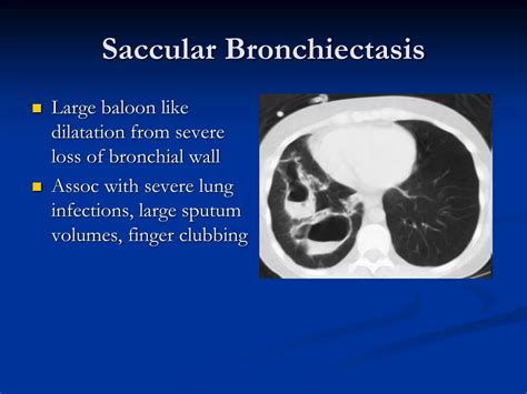 Ppt Chronic Lung Sepsis Powerpoint Presentation Free Download Id