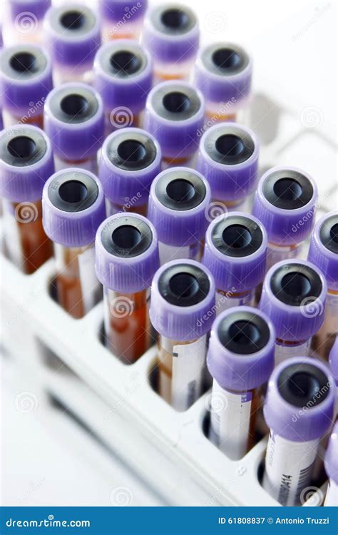 Rack With Test Tubes Of Blood Stock Image Image Of Nurse Science