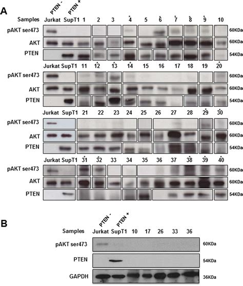 Representative Western Blot Analysis Of Akt Activated Aktser473 And